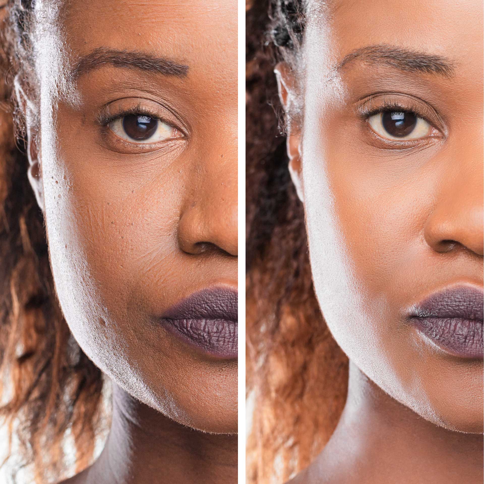 Microdermabrasion - DermaSweep - Santa Rosa